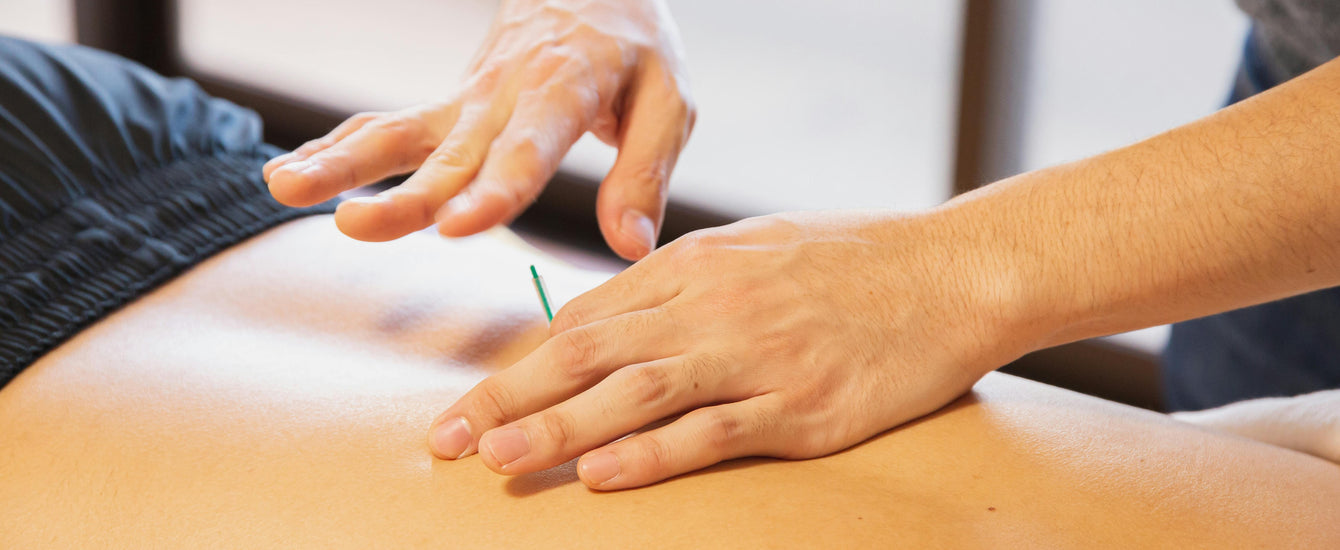 Dry Needling vs. Acupuncture: What's the Point? - NinjAthlete